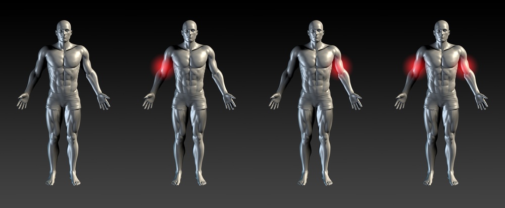 Torn Biceps Tendon: Symptoms, Causes, Risk Factors