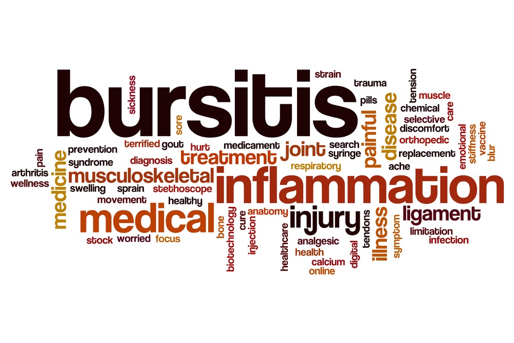 Bursitis: What Is It, Causes, and Areas of the Body Affected