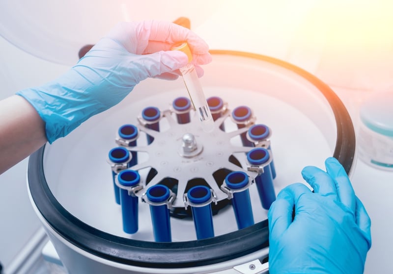 Platelet Rich Plasma Therapy (PRP): Process and Procedures