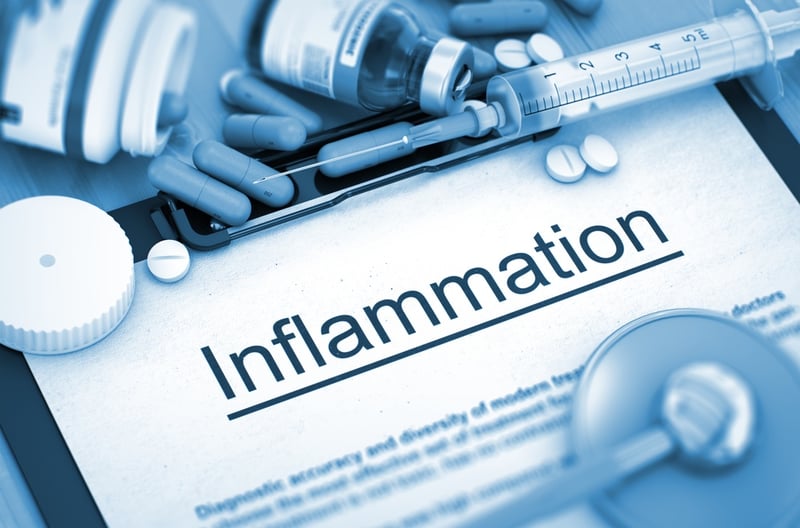 NSAIDs: When to Use Them, and How They Help Inflammation