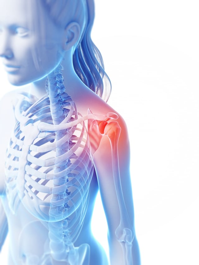 Most Common Sports Injuries for Women