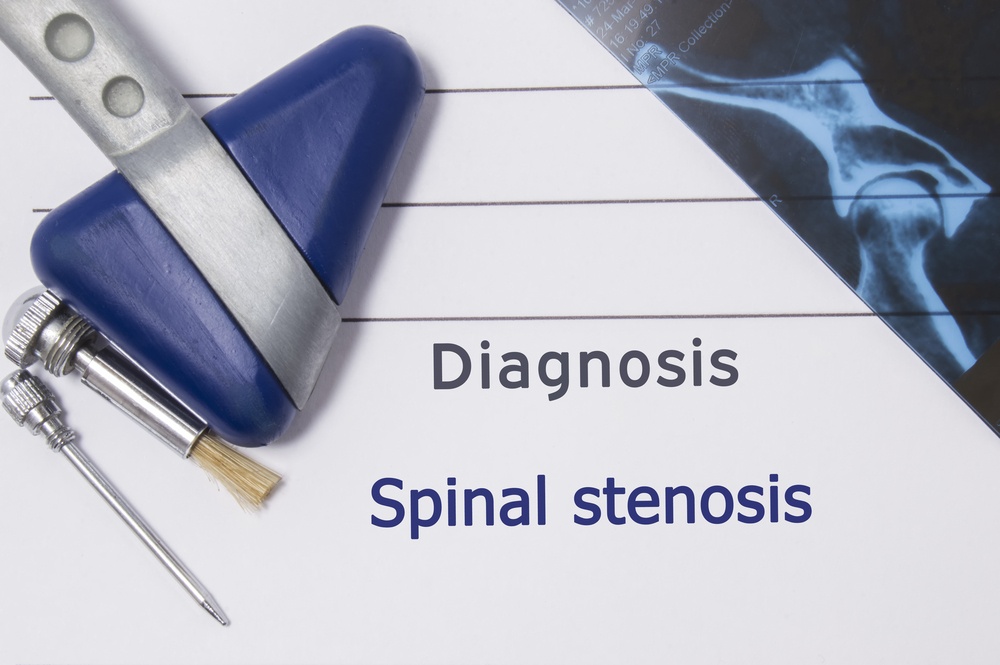 SPINAL STENOSIS DIAGNOSIS AND TREATMENT: SURGICAL VS. NON-SURGICAL OPTIONS