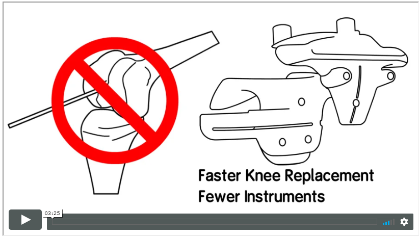 VISIONAIRE TOTAL KNEE ARTHROPLASTY: CANDIDATES, PROCEDURE, AND BENEFITS